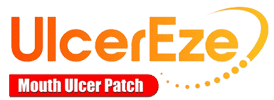 Mouth Ulcer Patch & Ulcer Treatment | UlcerEze